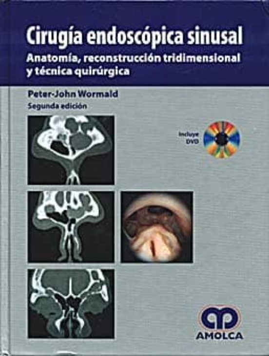 CIRUGIA ENDOSCOPICA SINUSAL: ANATOMIA, RECONSTRUCCION TRIDIMENSIO NAL Y ...